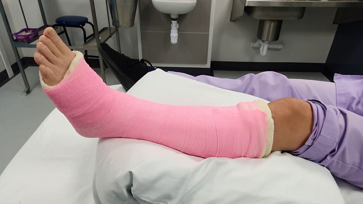 Kırık İyileşmesi Sırasında Sık Karşılaşılan Durumlar - Prof. Dr. Bülent ...